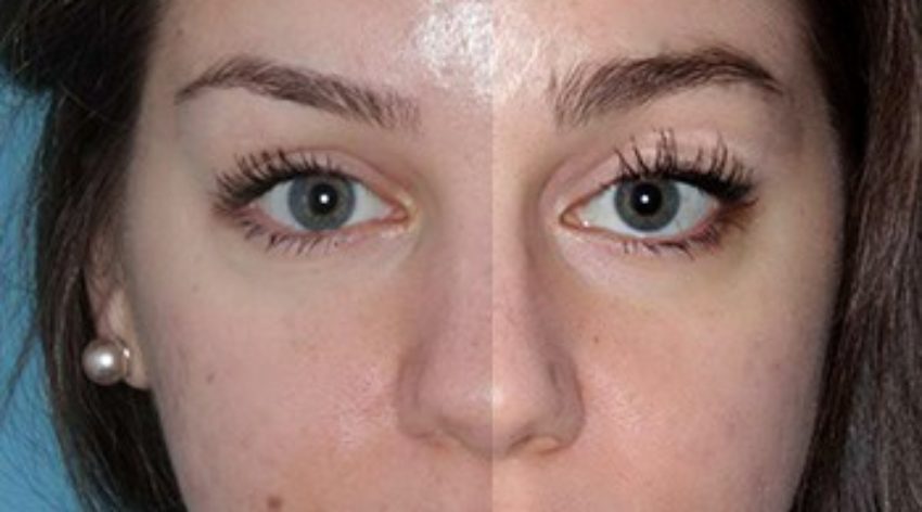 Latisse before and after eyebrows store